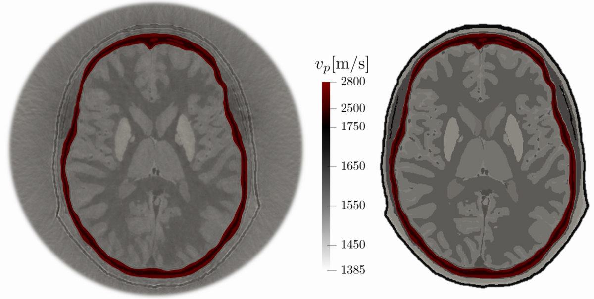 Imaging the brain with ultrasound waves | CSCS